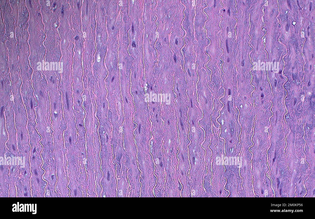Aorta elastic fibres, light micrograph Stock Photo - Alamy
