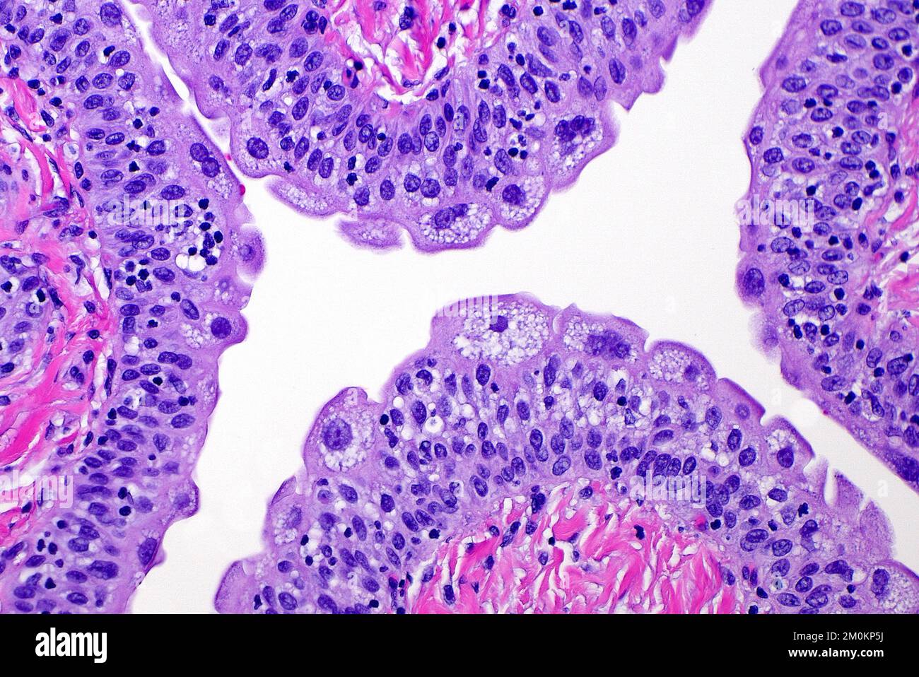 Umbrella urothelial cells, light micrograph Stock Photo - Alamy