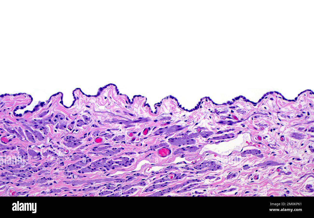 Mesothelial cells, light micrograph Stock Photo - Alamy