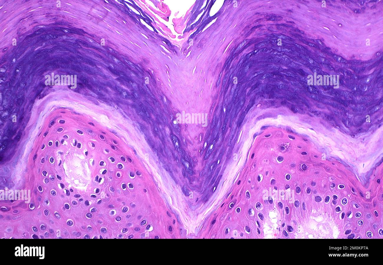 Epidermis, light micrograph Stock Photo - Alamy