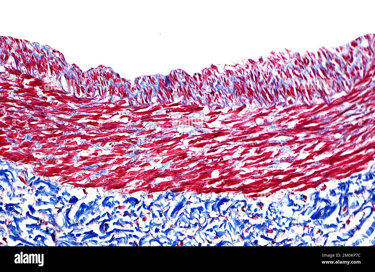Blood vessel wall, light micrograph Stock Photo - Alamy