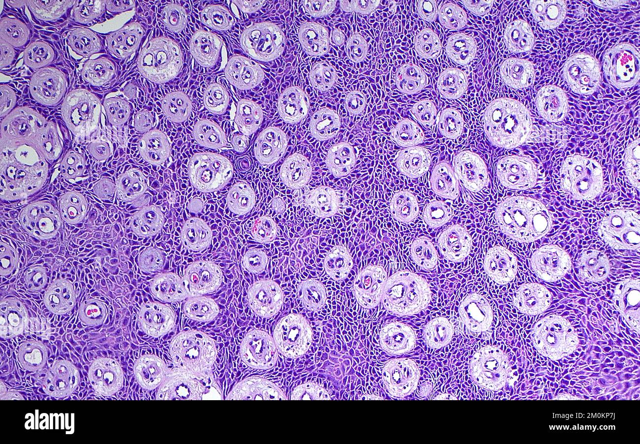 Skin epidermis, light micrograph Stock Photo - Alamy