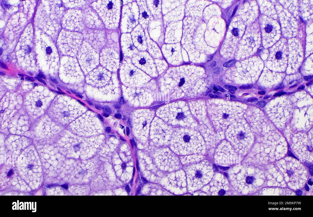 Sebaceous gland cells, light micrograph Stock Photo - Alamy