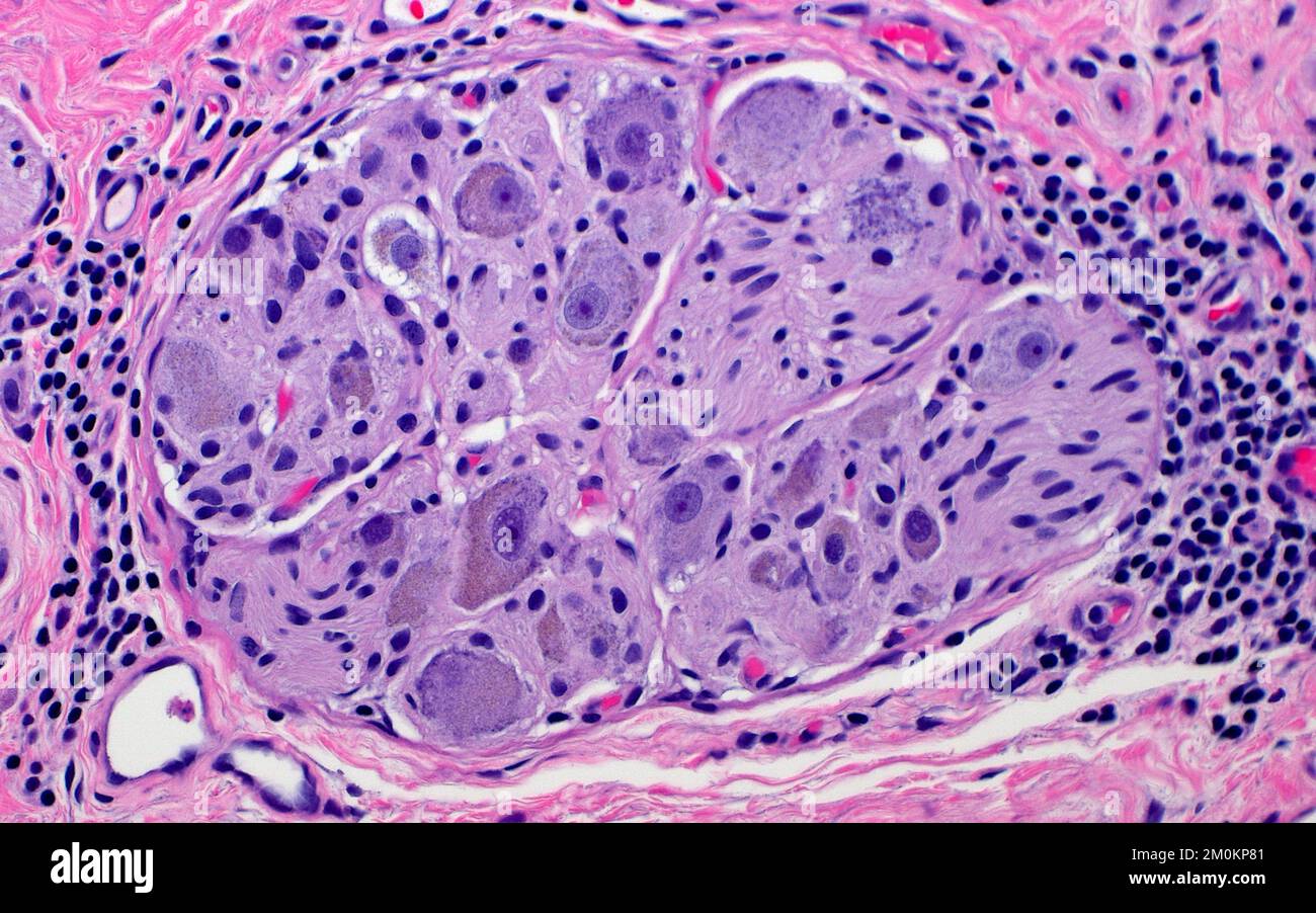 Ganglion nerve cells, light micrograph Stock Photo - Alamy