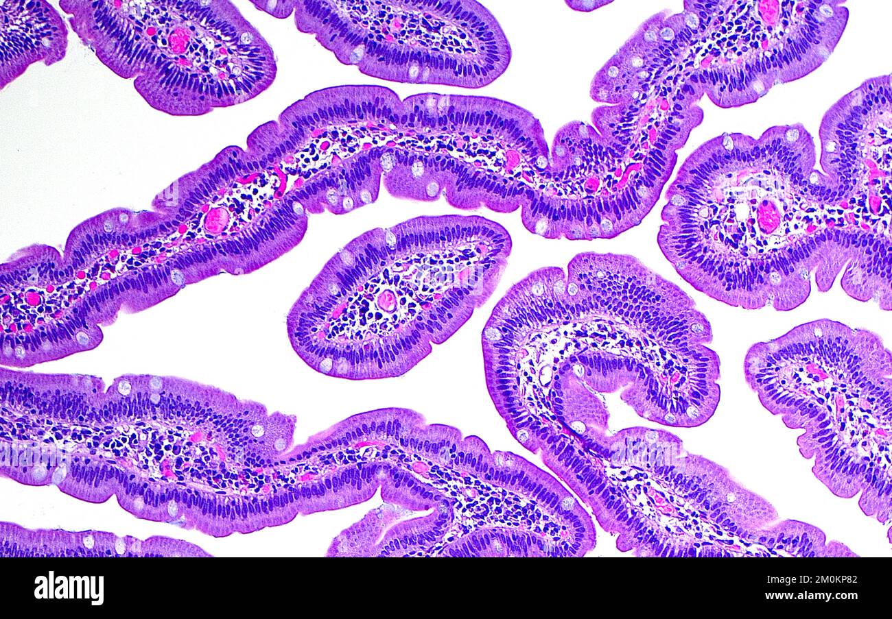 Intestinal villi, light micrograph Stock Photo - Alamy