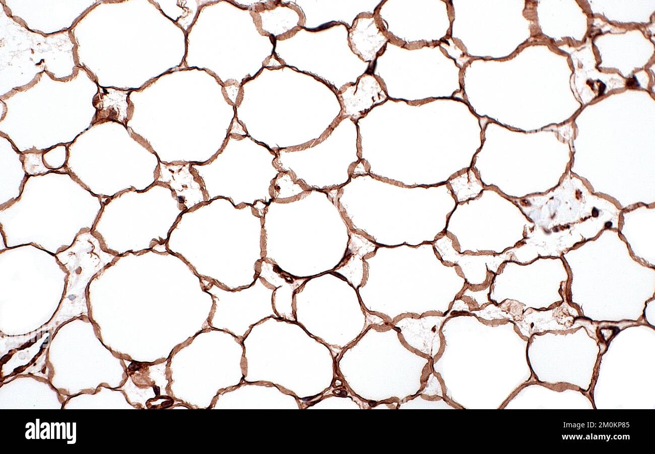 Fat cells, light micrograph Stock Photo - Alamy