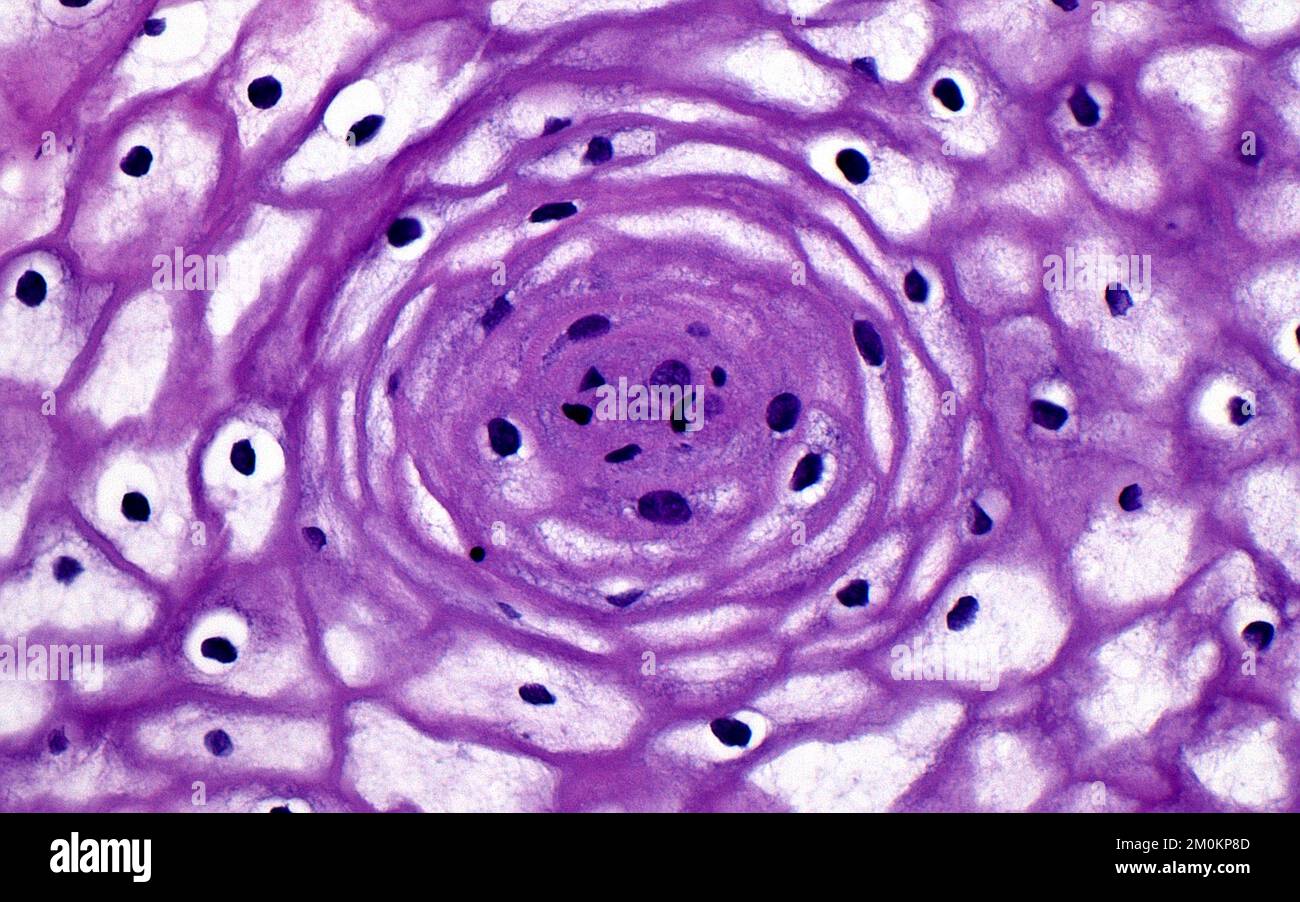 Cervix squamous cells, light micrograph Stock Photo - Alamy