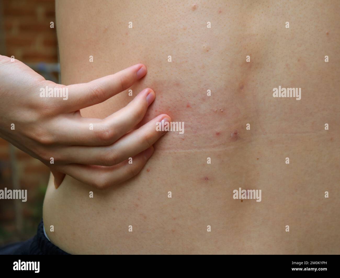 Puberty body hi-res stock photography and images - Alamy