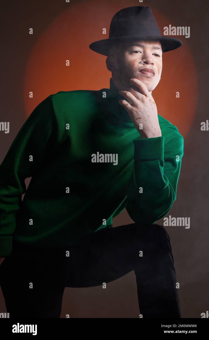 Vitiligo male model hi-res stock photography and images - Alamy