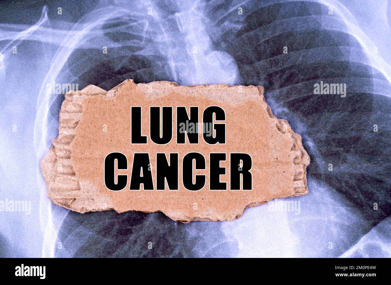 Medicine concept. On the X-ray there is a piece of cardboard with the ...