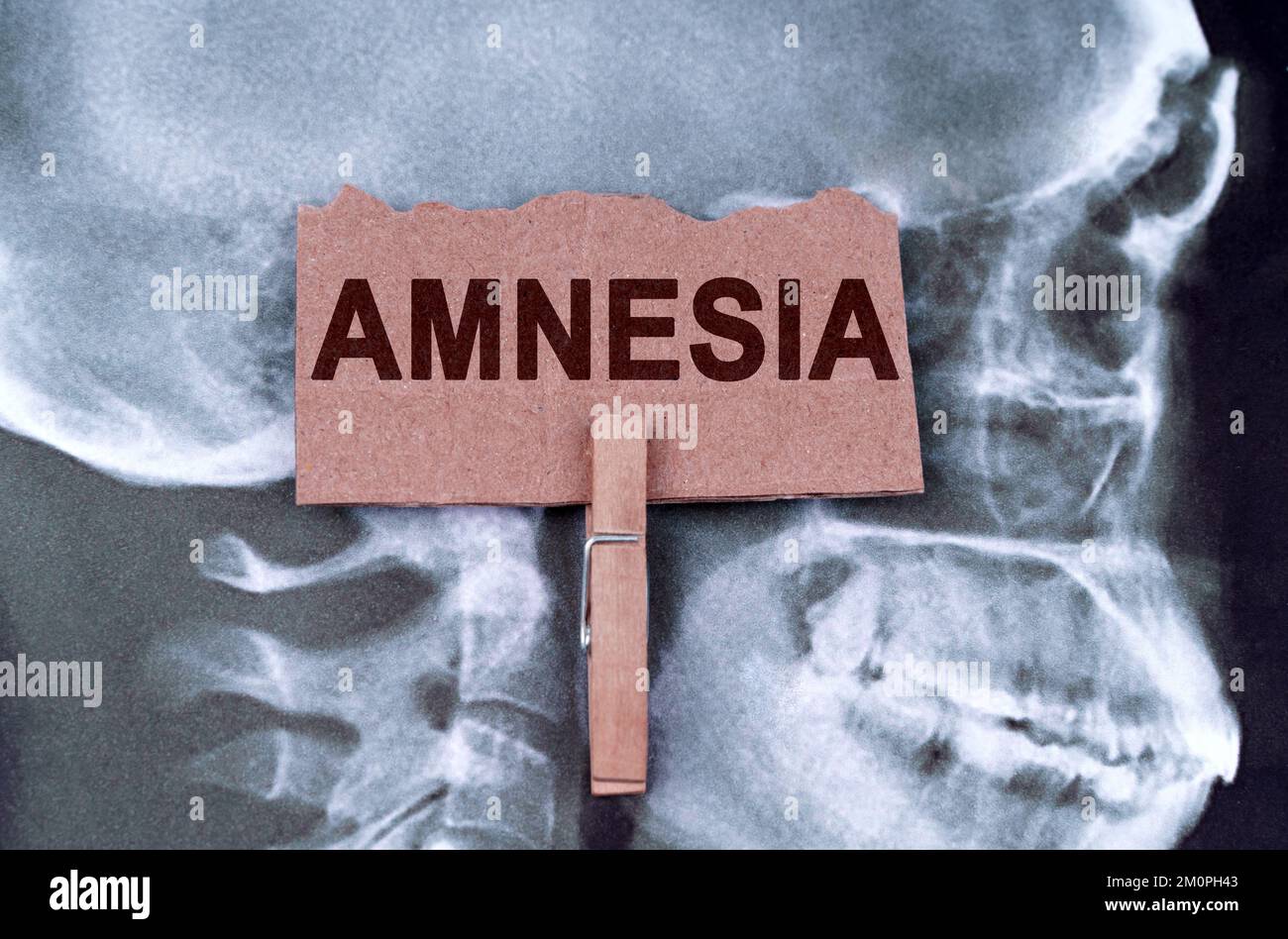 Medicine concept. Against the background of an X-ray of the skull, a ...