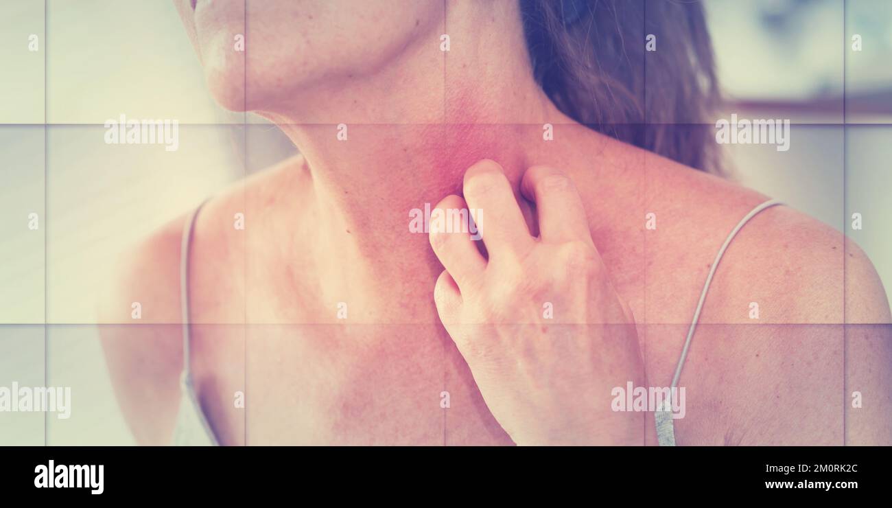 Woman having itchy and scratching her neck. allergy symptoms, geometric pattern Stock Photo - Alamy