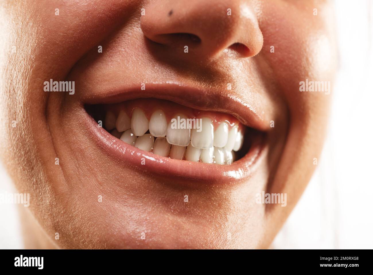Close up of a girls good looking teeth at the studio Stock Photo - Alamy