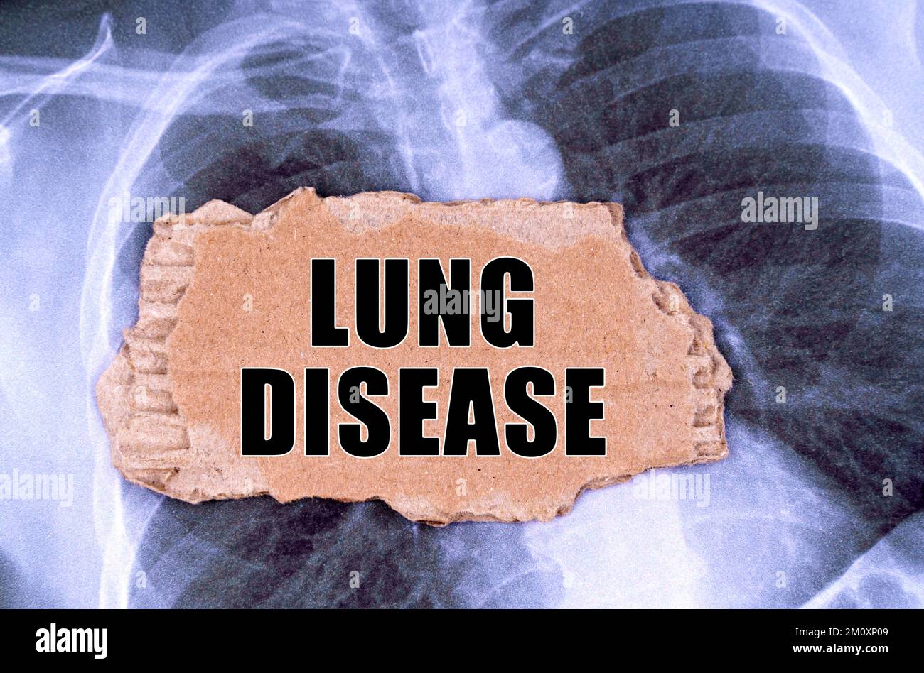 Medicine concept. On the X-ray there is a piece of cardboard with the ...