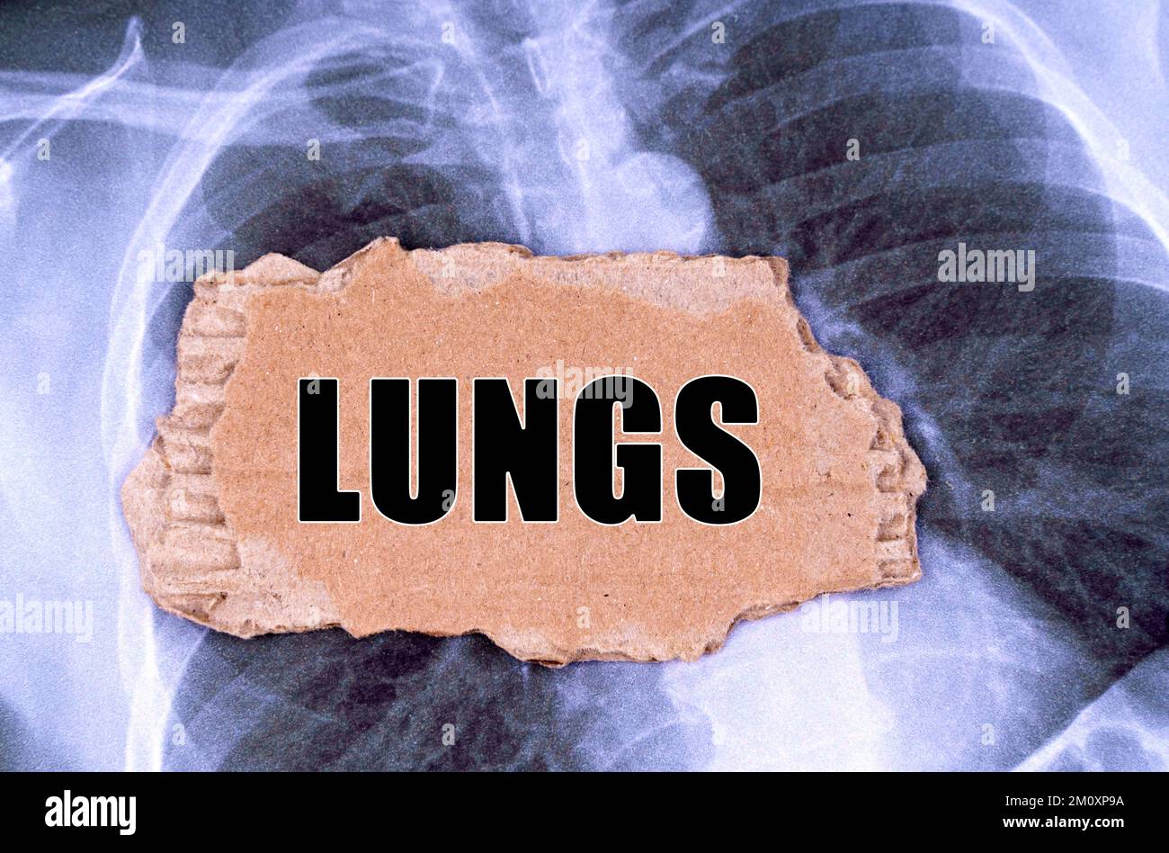 Medicine concept. On the X-ray there is a piece of cardboard with the ...