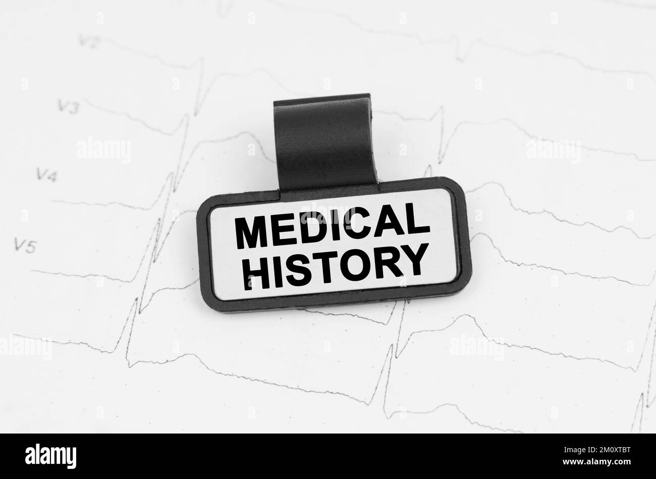 Medicine and health concept. There is a plate on the cardiogram with ...