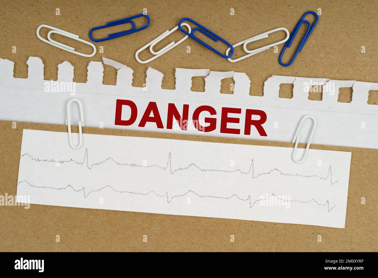 Medicine and health concept. On the table lies a cardiogram, paper ...