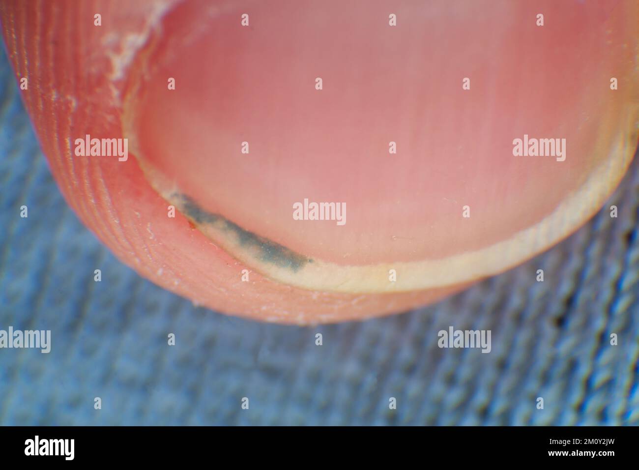 The nail super macro hi-res stock photography and images - Alamy