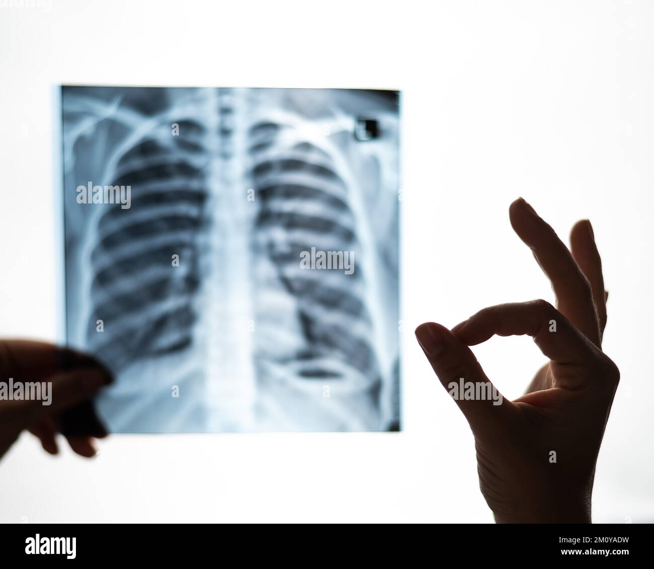 The doctor looks at the x-ray of the patient's lungs and shows the ok ...