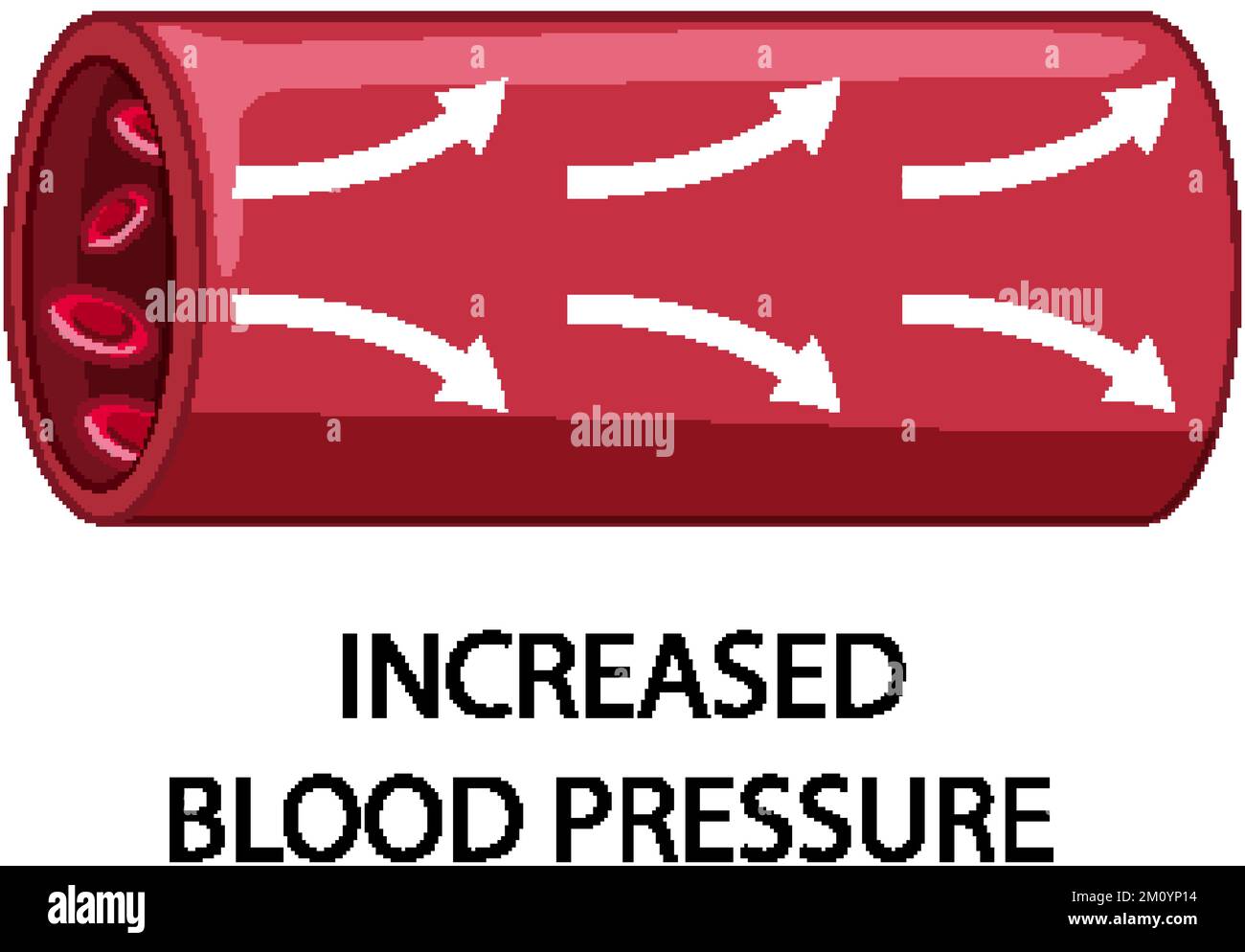 Blood flow with increased blood pressure text illustration Stock Vector ...