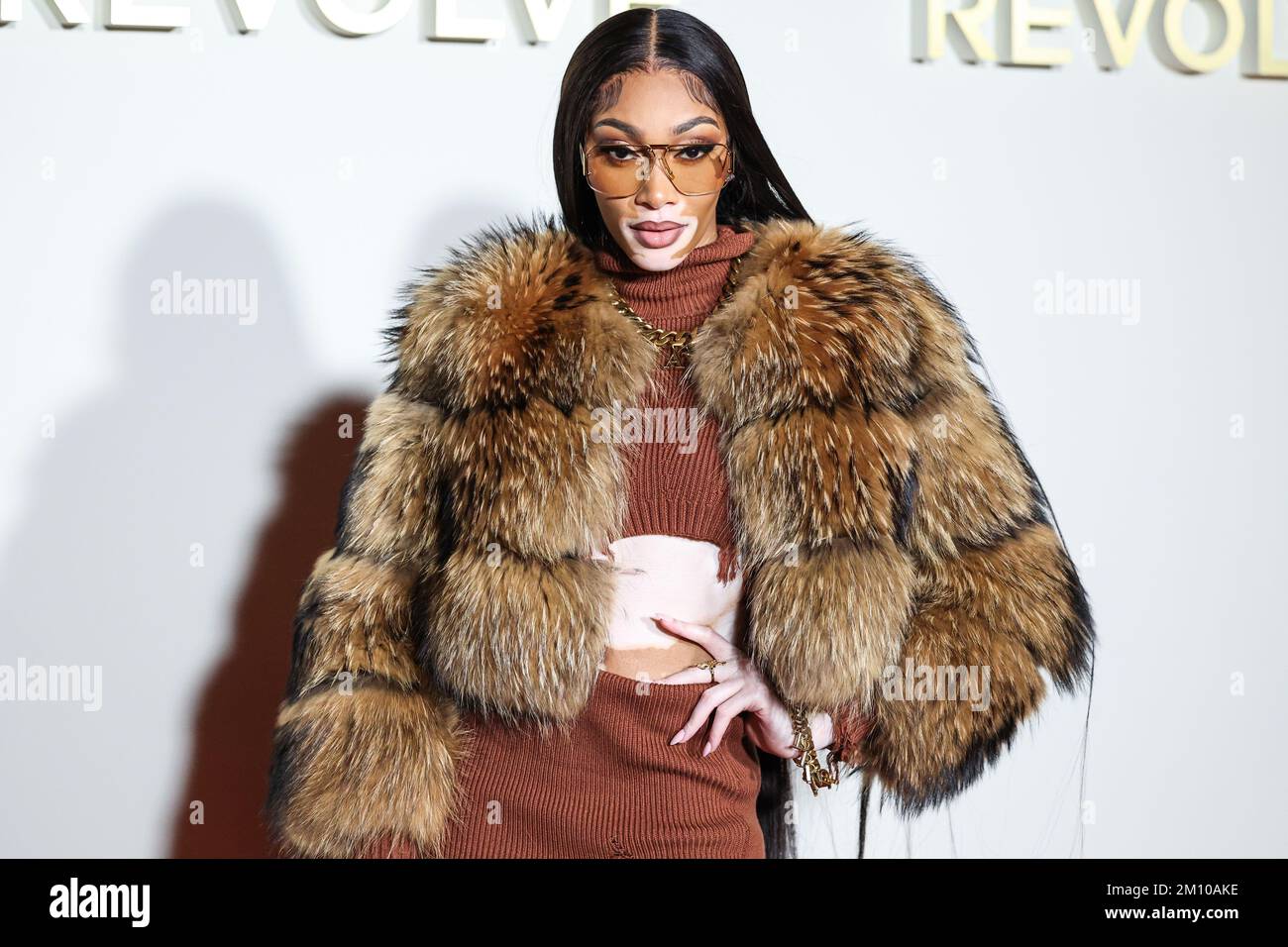 Winnie harlow skin hi-res stock photography and images - Alamy