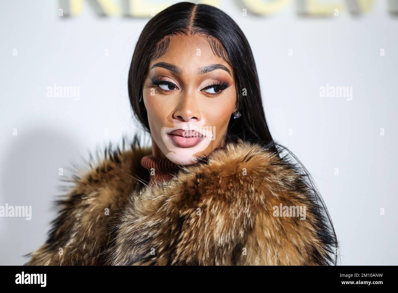 Winnie harlow skin hi-res stock photography and images - Alamy
