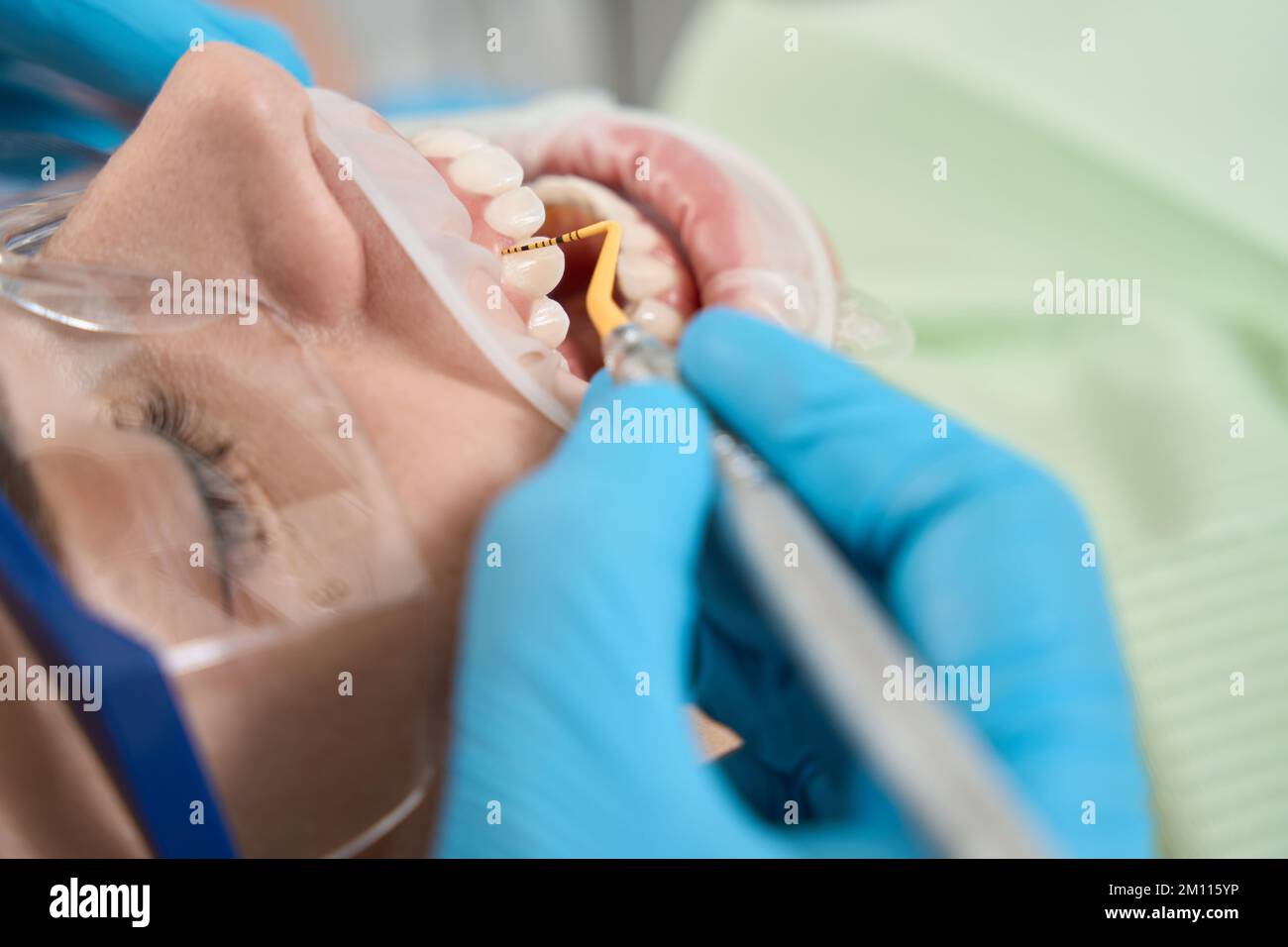 Teeth scaling hi-res stock photography and images - Alamy