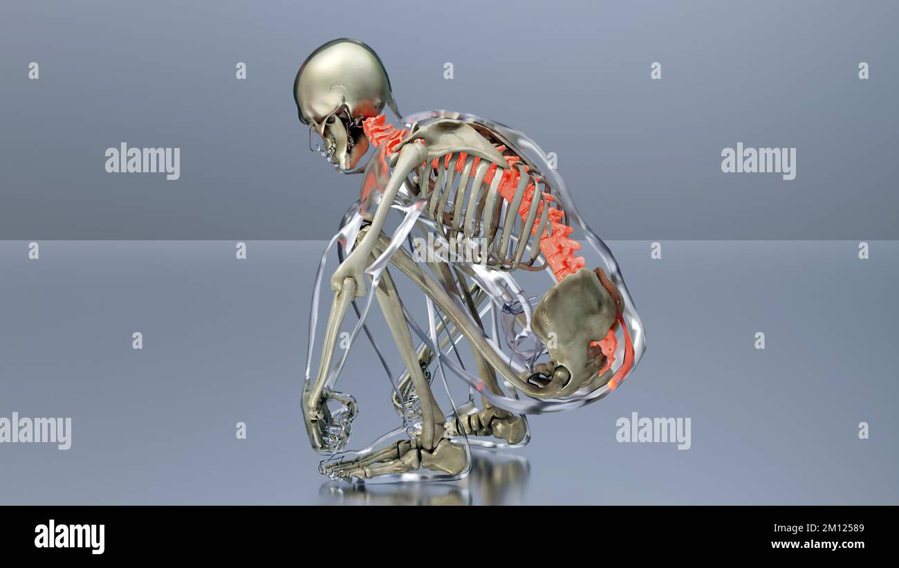 Human Skeleton System Anatomy Concept. Red on the backbone, medically ...