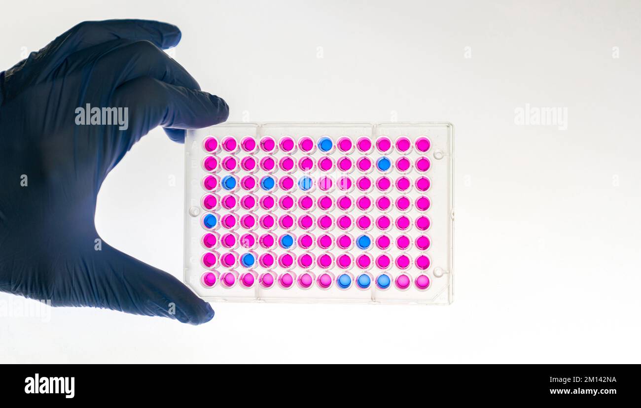 Elisa assay hi-res stock photography and images - Alamy