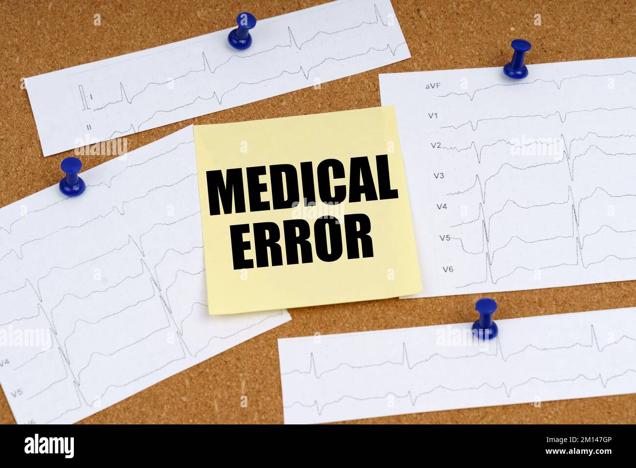 Medicine and health concept. Attached to the board are cardiogram ...