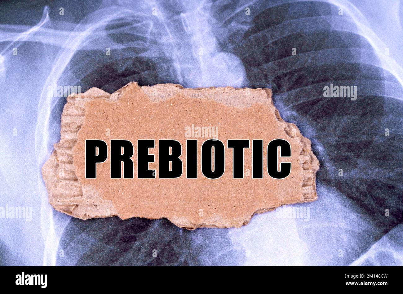 Medicine concept. On the X-ray there is a piece of cardboard with the ...