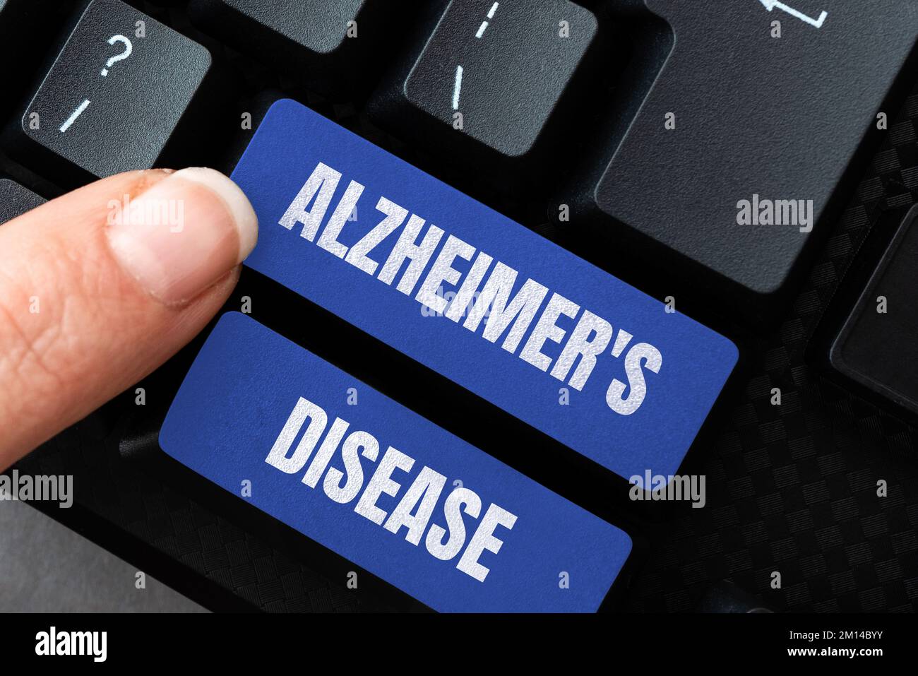 Hand writing sign Alzheimer's Disease. Word for Advanced mental ...