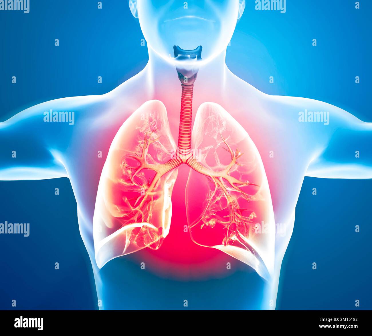 Human anatomy, problems with the respiratory system, severely damaged ...