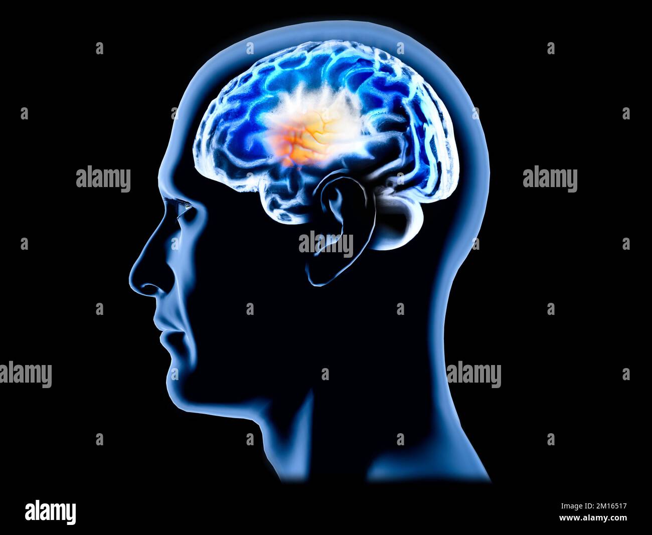 Section of a brain seen in profile, parts of the brain. Degenerative ...