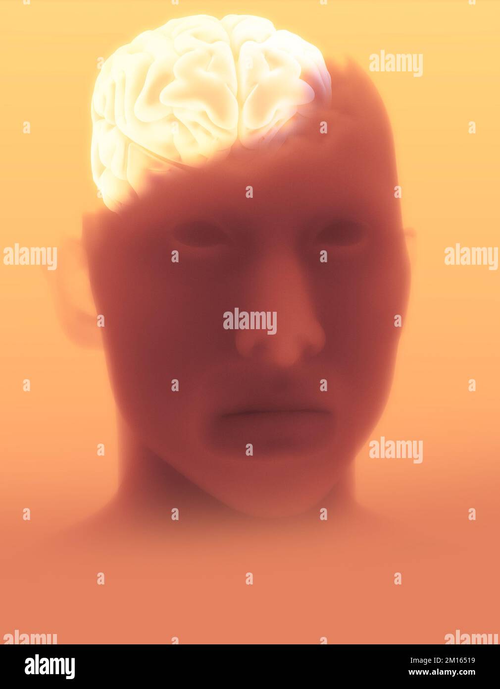 Section Of A Brain Seen In Profile Parts Of The Brain Degenerative