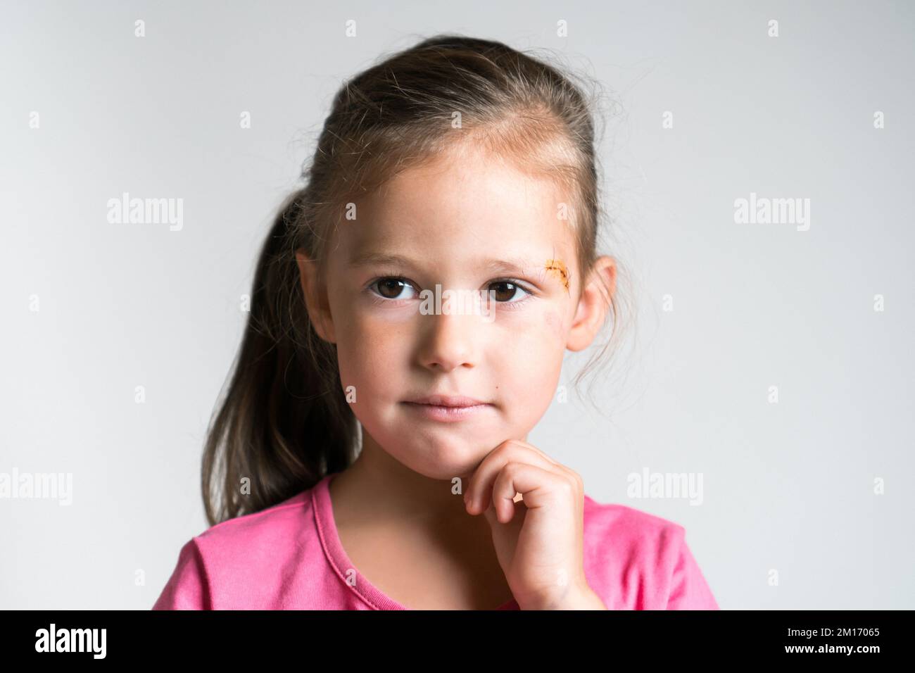 Close up pensive, lovely blond little child, girl with injury, scratch ...