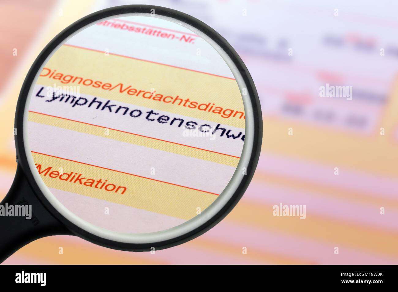 Lymphknotenschwellung hi-res stock photography and images - Alamy