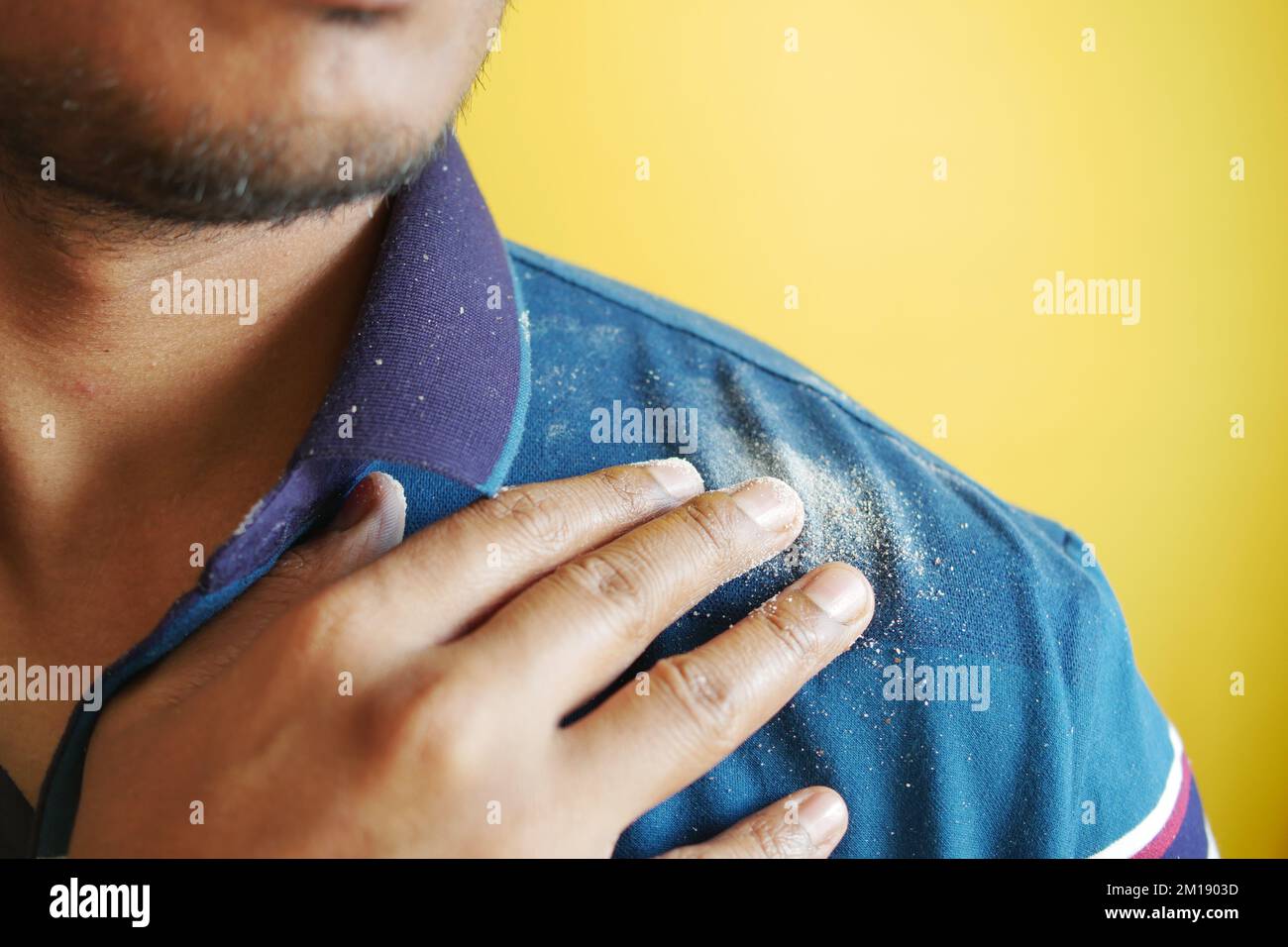 men with dandruff ion his coat Stock Photo - Alamy