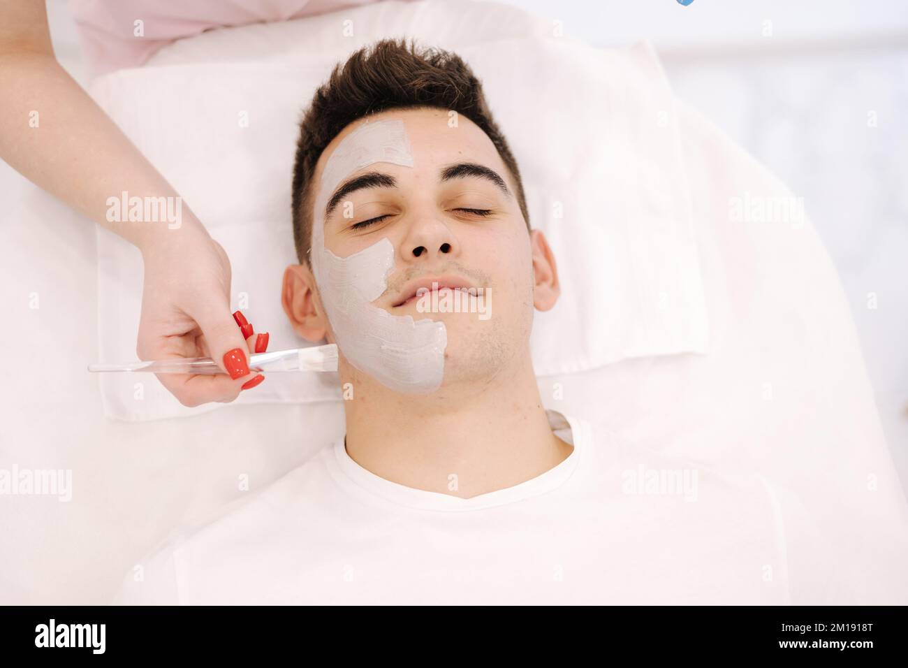 Close-up of male face during procedure. Pimples and blackheads on the ...