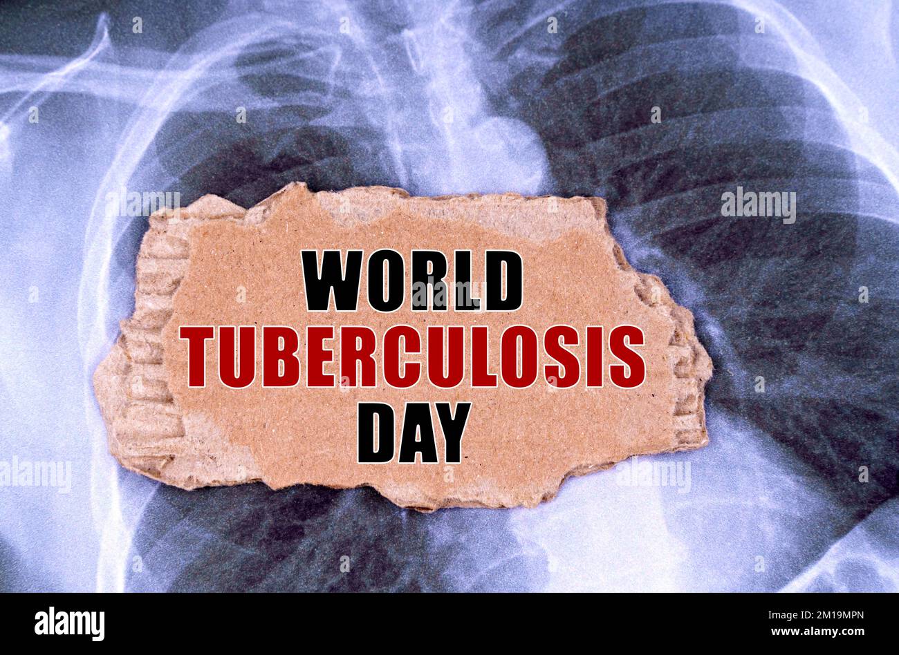 Medicine concept. On the X-ray there is a piece of cardboard with the ...