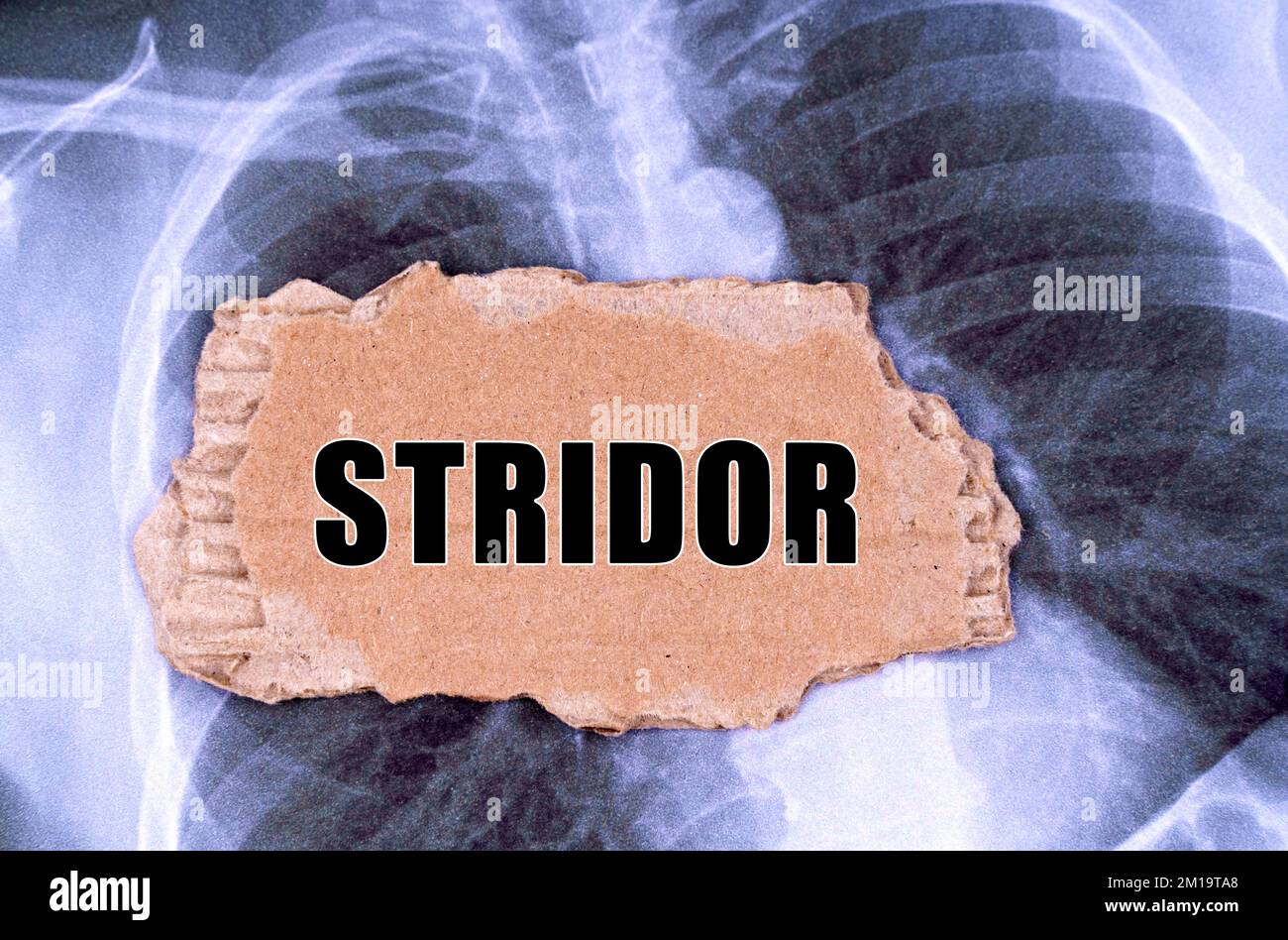 Medicine concept. On the X-ray there is a piece of cardboard with the inscription - stridor ...