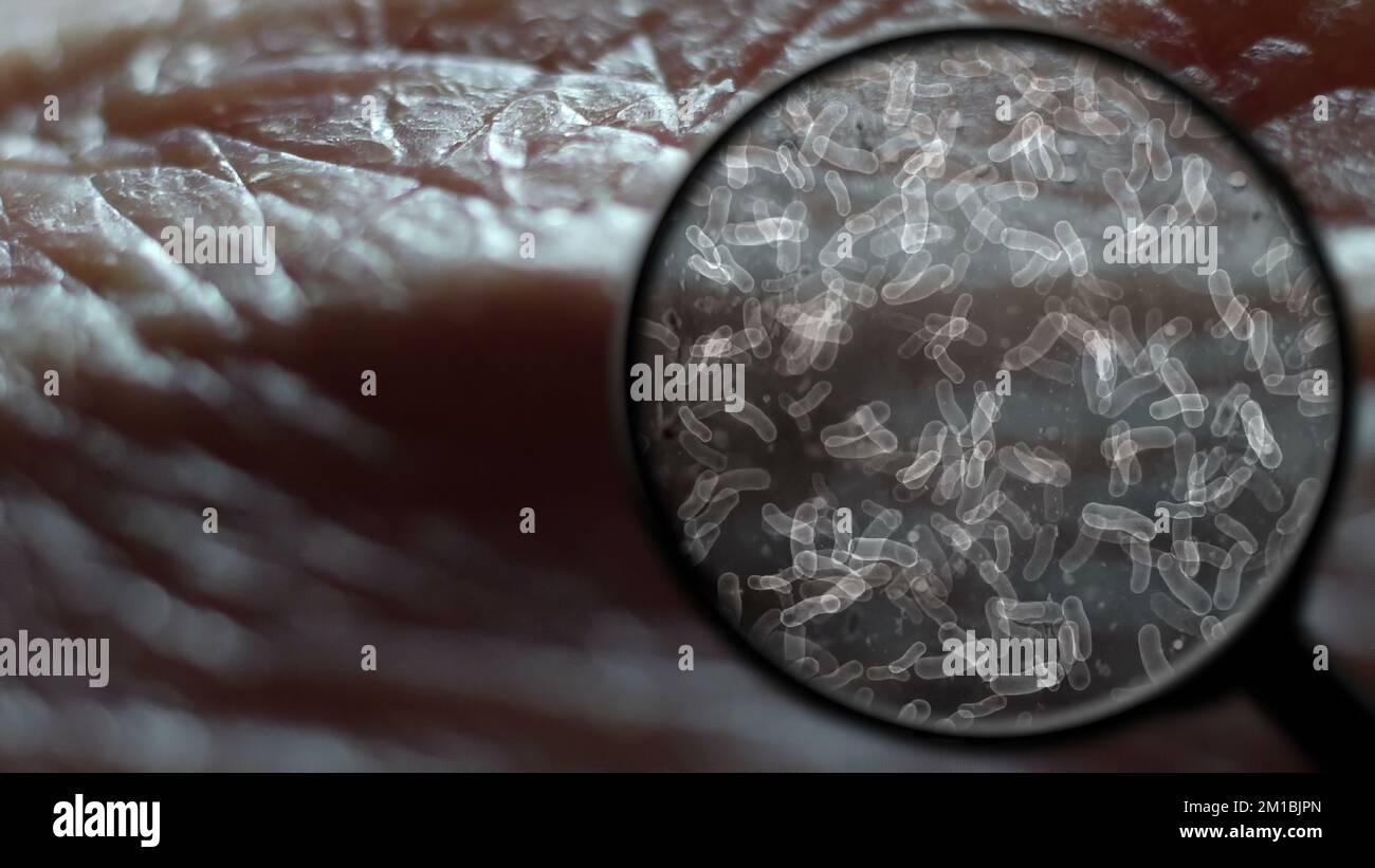 Searching for bacteria on human skin Stock Photo - Alamy