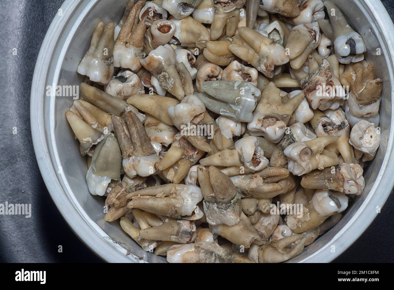 the bundle of unwanted extracted decay human teeth Stock Photo - Alamy