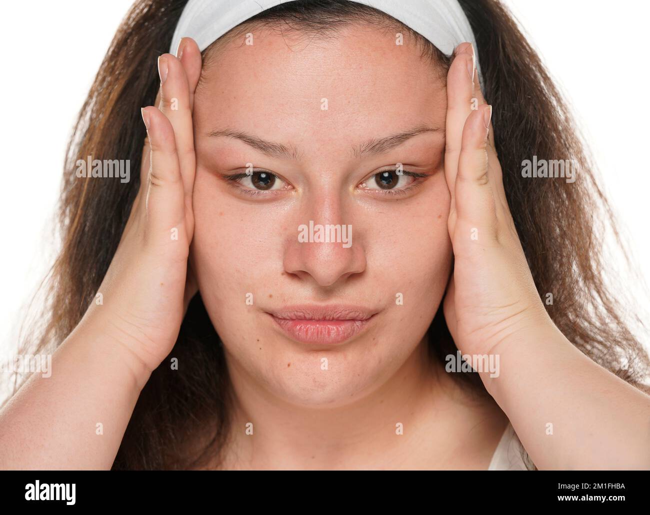 Young chubby woman tightening her face skin with her palms on a white ...