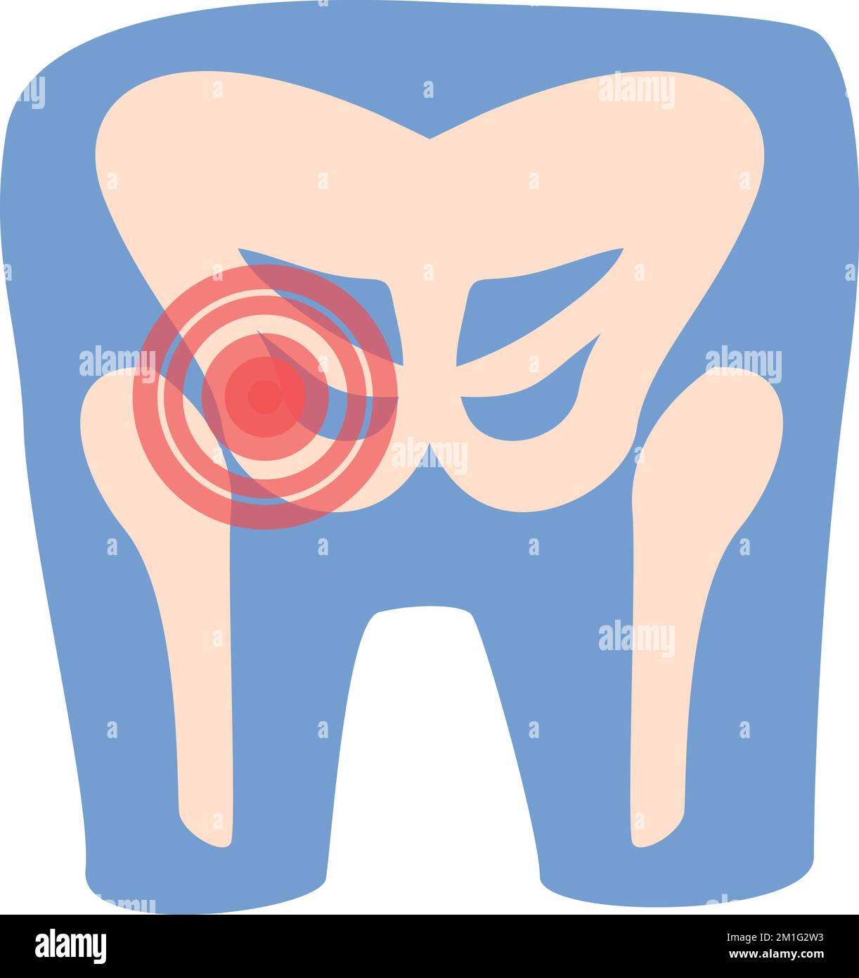 Joint pain icon cartoon vector. Medical arthritis. Patient clinic Stock ...