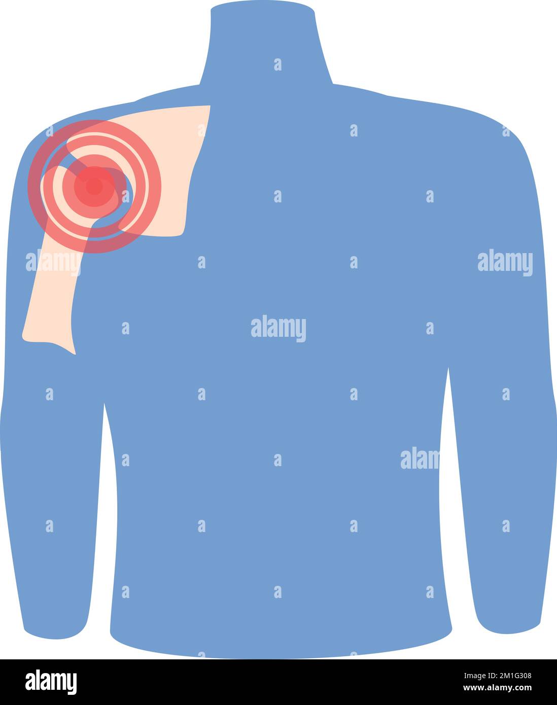 Human inflamed ankle Stock Vector Images - Alamy