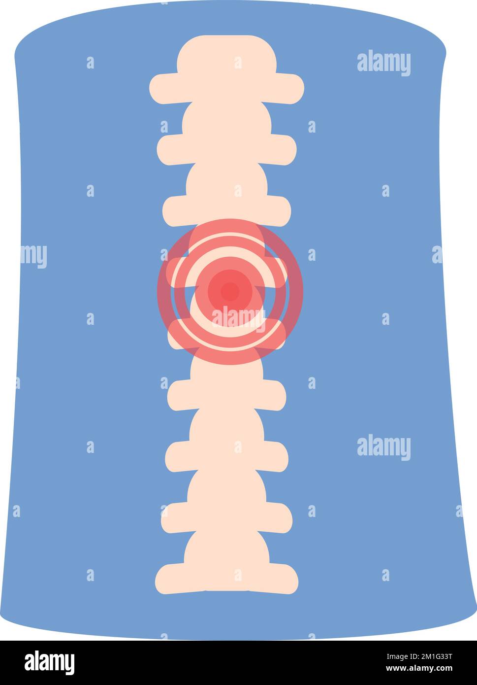 Spine pain icon cartoon vector. Arthritis joint. Medical treatment ...