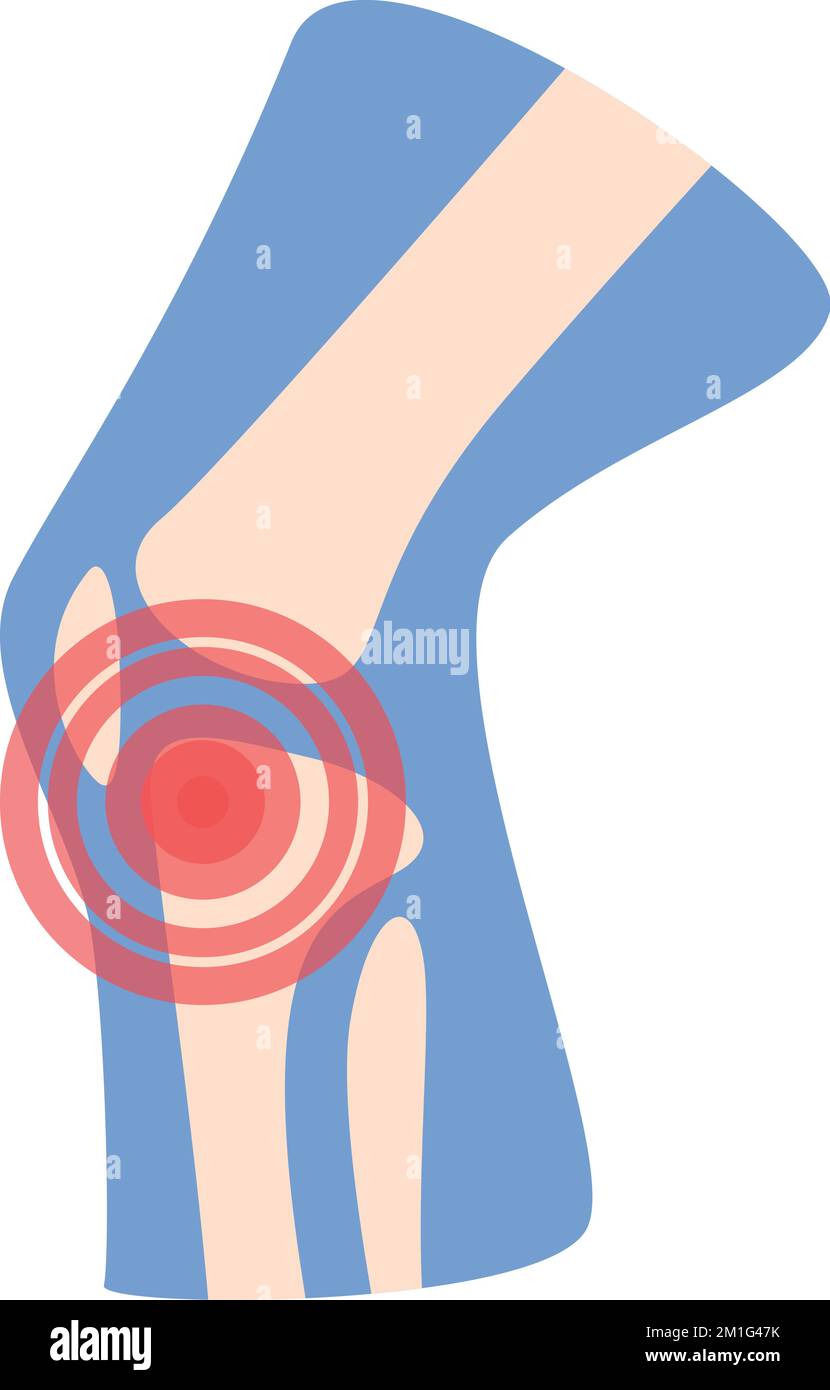 Articulation icon cartoon vector. Arthritis joint. Medical treatment ...