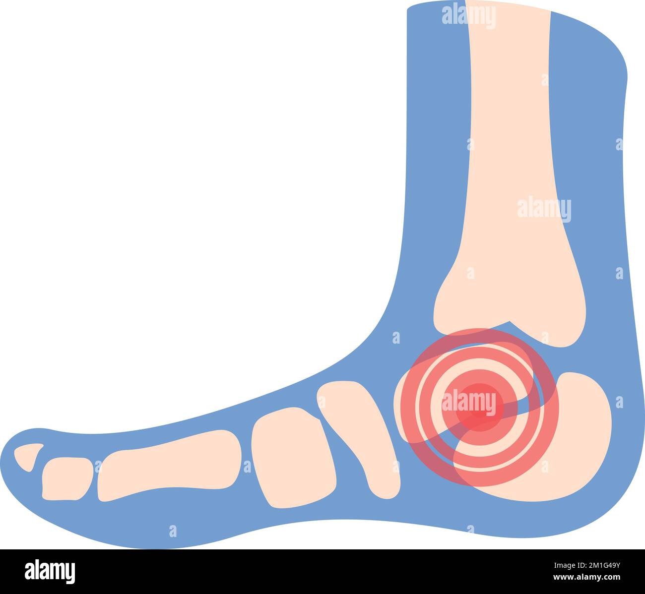 Foot articulation icon cartoon vector. Medical patient. Arthritis joint ...