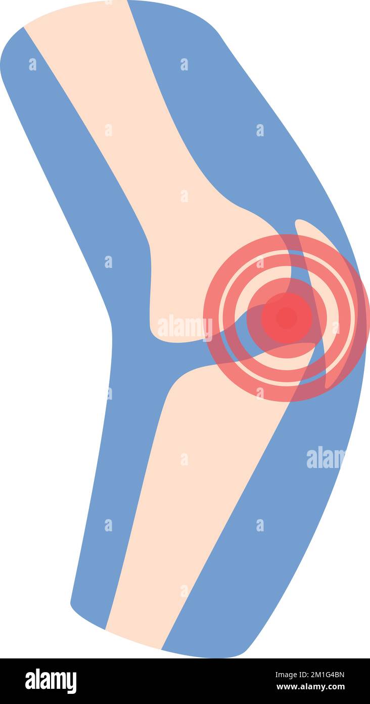 Knee pain icon cartoon vector. Arthritis joint. Medical articulation ...